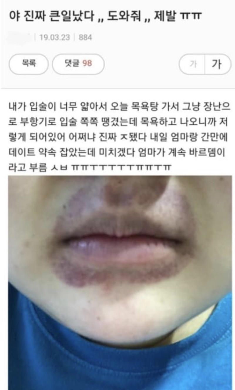 부항으로 장난치다가 - 에누리 쇼핑지식 자유게시판