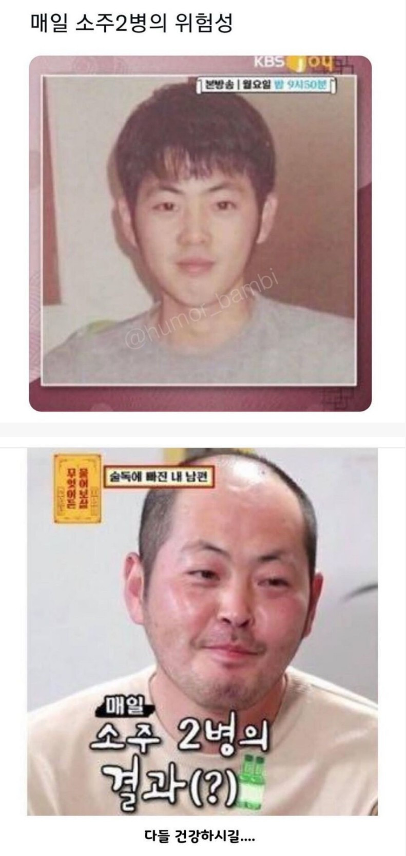 매일 소주 2병의 위험성 - 에누리 쇼핑지식 자유게시판