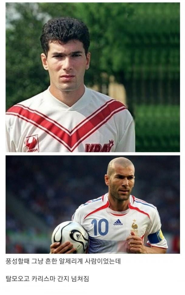 탈모와도 이 정도로 잘 어울린다면 - 에누리 쇼핑지식 자유게시판