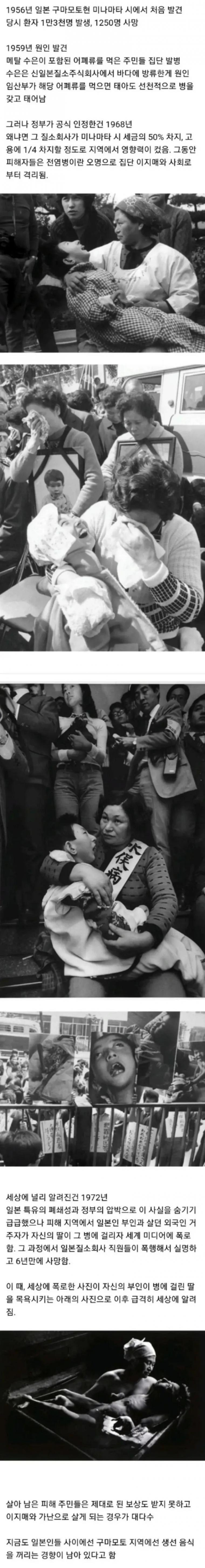 일본 정부에서 숨기려 했던 병 - 에누리 쇼핑지식 자유게시판